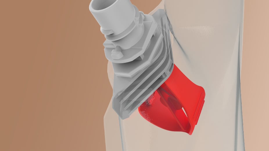 DaklaPack: ‘Ontdek met EasyDose een nieuwe manier van doseren’